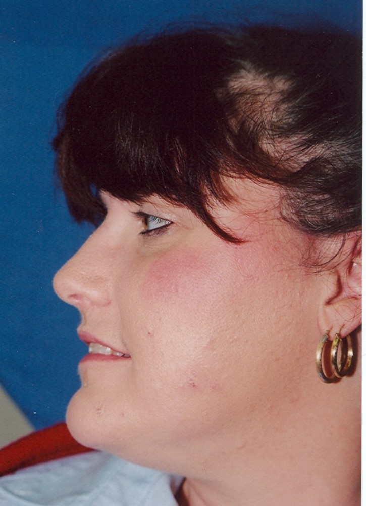 Obagi skin care products | Allentown PA