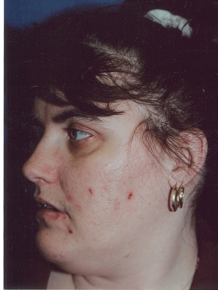 Obagi skin care products | Allentown PA